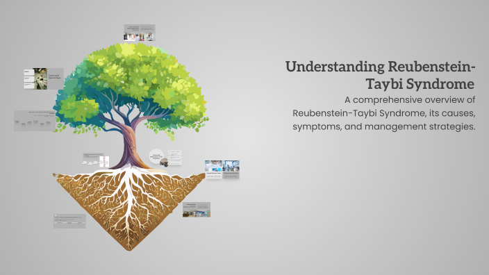 Understanding Reubenstein-Taybi Syndrome by Akhil A S on Prezi