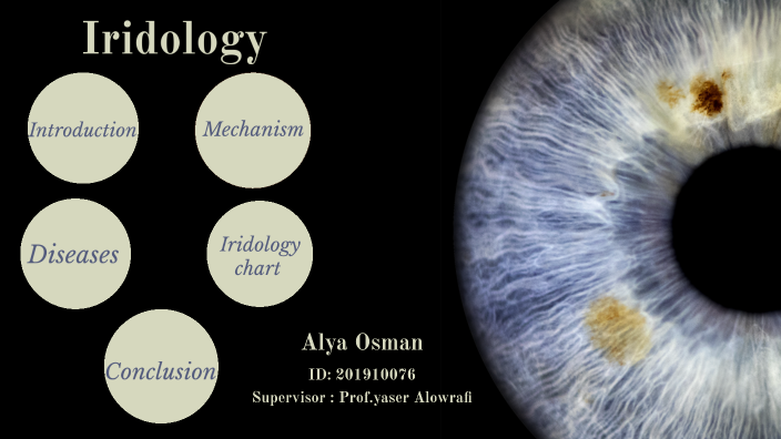 iridology by alya on Prezi