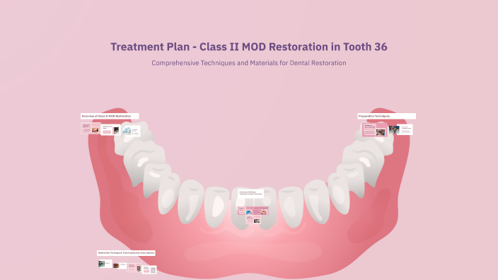 Treatment Plan - Class II MOD Restoration in Tooth 36 by Josiel Kuc on ...