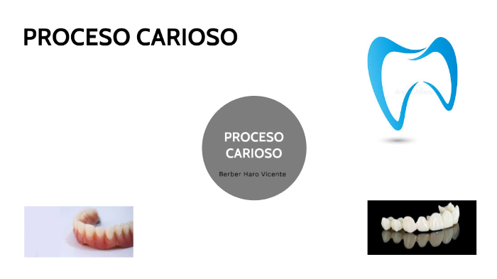 proceso carioso by vicente berber haro on Prezi