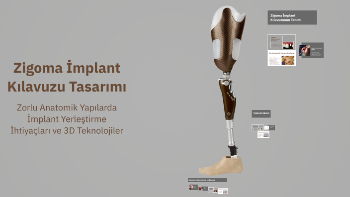 Zigoma İmplant Kılavuzu Tasarımı by ALPER ERKEN on Prezi