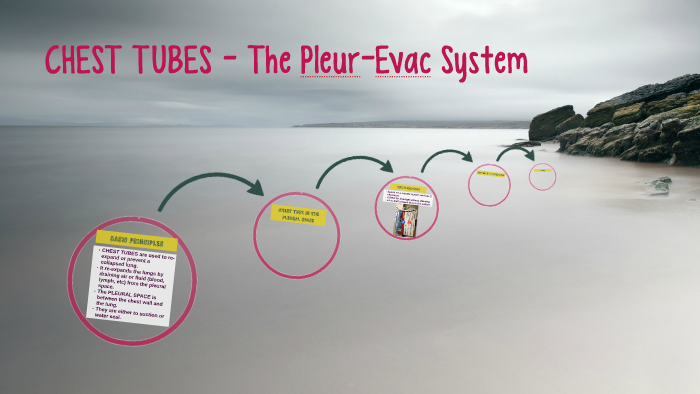 CHEST TUBES - The Pleur-Evac System by Alta Bates ICU on Prezi