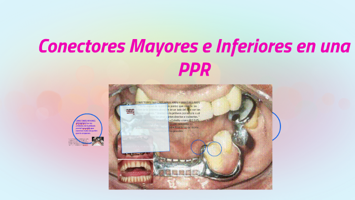 Conectores Mayores e Inferiores en una PPR by veronica hernandez on Prezi