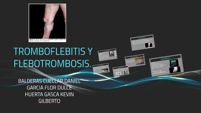 TROMBOFLEBITIS Y FLEBOTROMBOSIS. by CECILIA SANCHEZ on Prezi