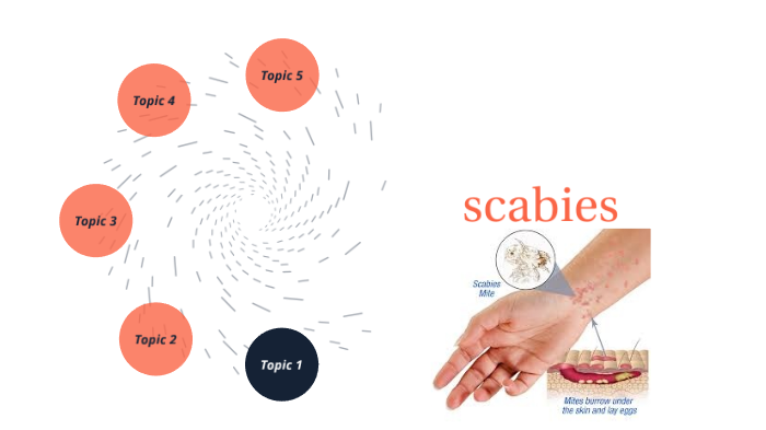 parasitic infection scabies by Patricia Bowers