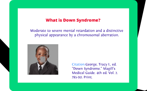 Down Syndrome by Adia Coleman on Prezi