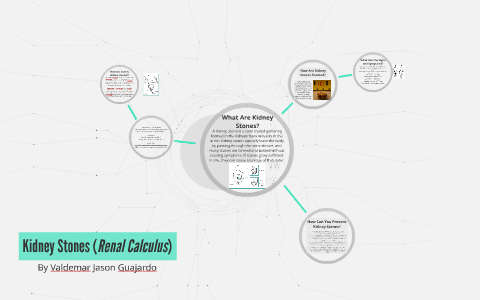 Kidney Stones By Valdemar Jason Guajardo by He Who Must Not Be Named on ...