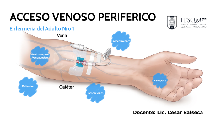 ACCESO VENOSO PERIFERICO by Cesar Balseca on Prezi