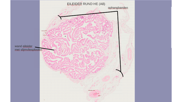 A8 EILEIDER RUND HE by louk boucher on Prezi