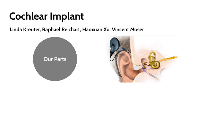 Cochlea Implant by Vincent Moser on Prezi
