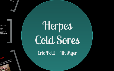 Herpes- Cold Sores by Eric Polli on Prezi