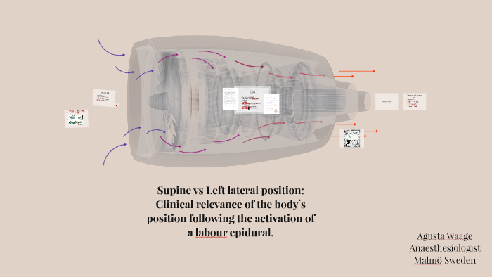 Supine vs Left lateral position: Clinical relevance of the b by Ágústa ...