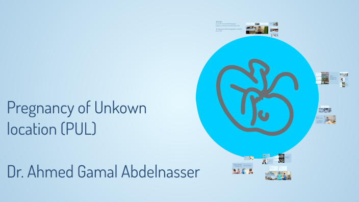 Understanding Pregnancy of Unknown Location (PUL) by Ahmed Ali on Prezi