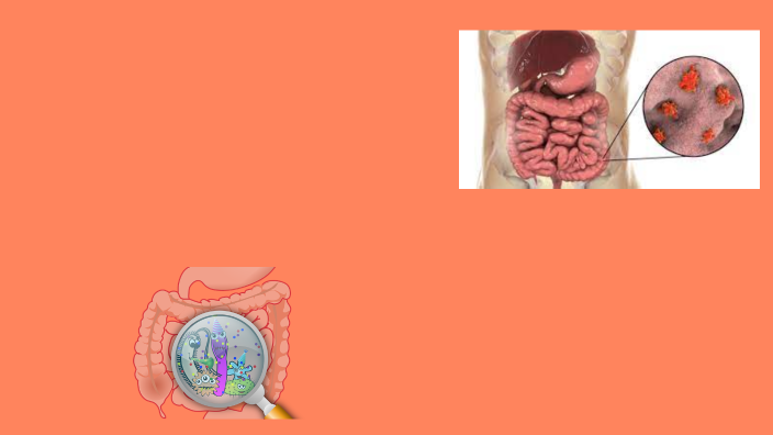 Amebiasis intestinal YNCR by Yaretzi Nayeli Cipriano Roman on Prezi