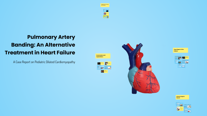 Pulmonary Artery Banding: An Alternative Treatment in Heart Failure by ...