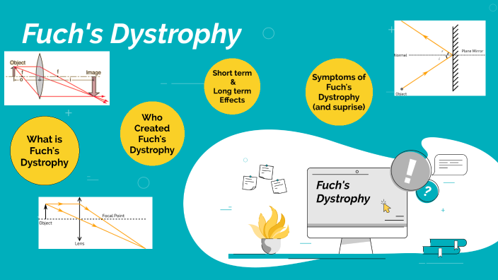 Fuchs Dystrophy by Lucas Carasis on Prezi