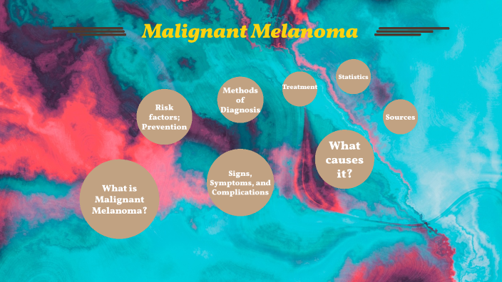 Malignant Melanoma by faith cowley on Prezi