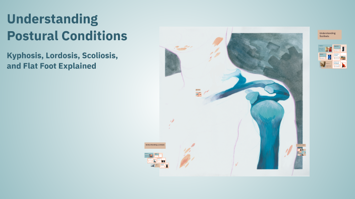 Understanding Postural Conditions by amina Giliazova on Prezi