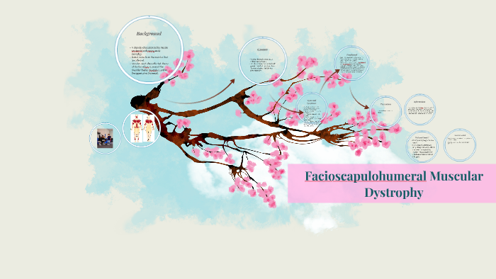 Facioscapulohumeral Muscular Dystrophy by Karen Davis on Prezi