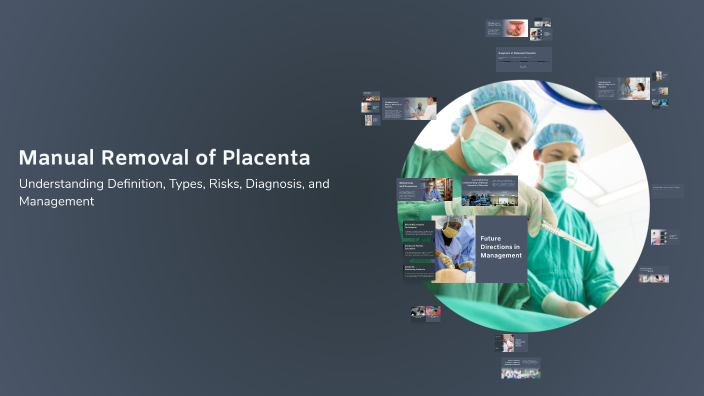 Manual Removal of Placenta by Suhu Bilaal on Prezi