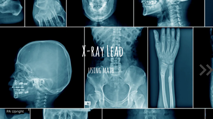 Xray by Adela Flores on Prezi