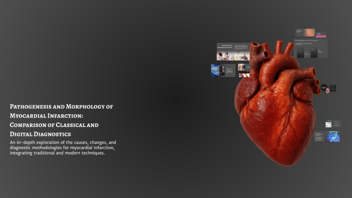 Pathogenesis and Morphology of Myocardial Infarction: Comparison of ...
