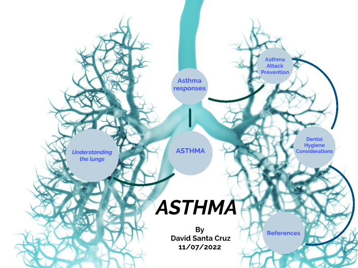 ASTHMA by David Santa Cruz Patroni on Prezi