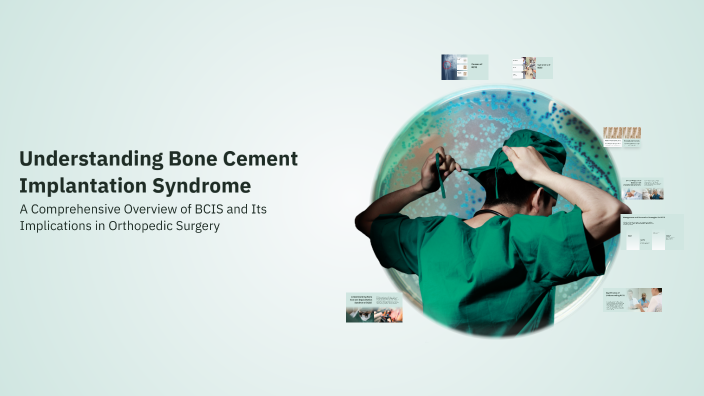 Understanding Bone Cement Implantation Syndrome by Muhammad Usman Gul ...