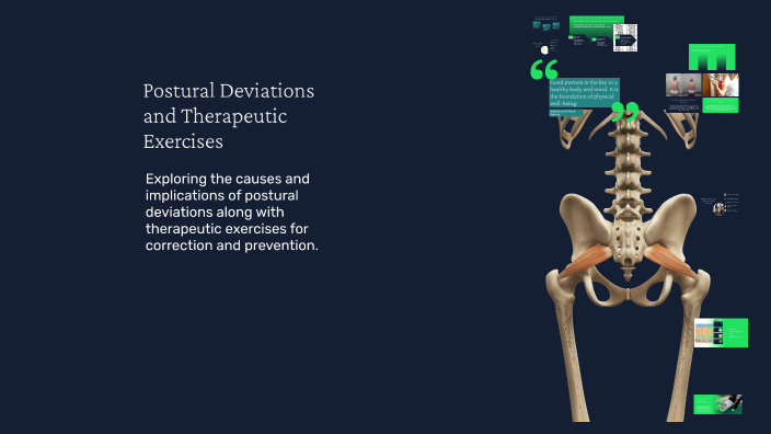 Postural Deviations and Therapeutic Exercises by AbdElRahman Mohammed ...