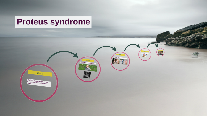 proteus syndrome by baha shihadeh on Prezi