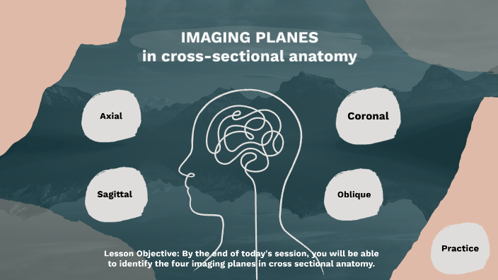 IMAGING PLANESin cross-sectional anatomy by Rachel Benson on Prezi