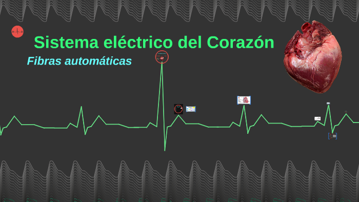 Sistema electrico del Corazón by Luis Fernando Ceballos on Prezi