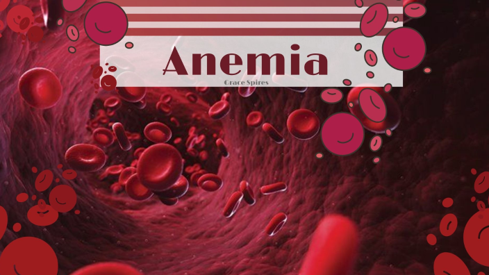 Anemia by Grace Spires on Prezi