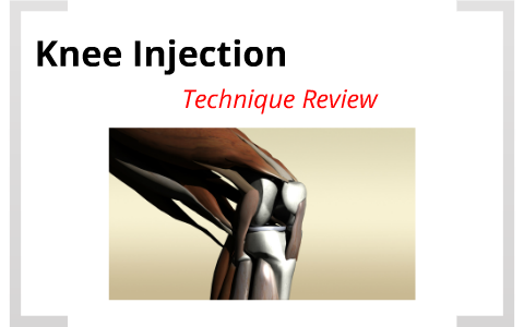 Knee Injection - Procedure Review by Michael Tuggy on Prezi