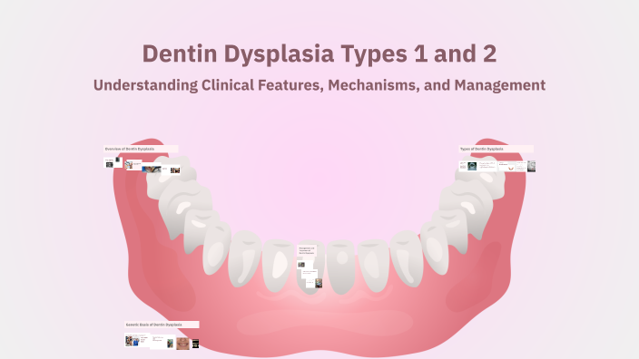 Dentin Dysplasia Types 1 and 2 by Kelly Chigua on Prezi