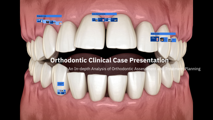 Orthodontic Clinical Case Presentation by Ghadah Yousef on Prezi