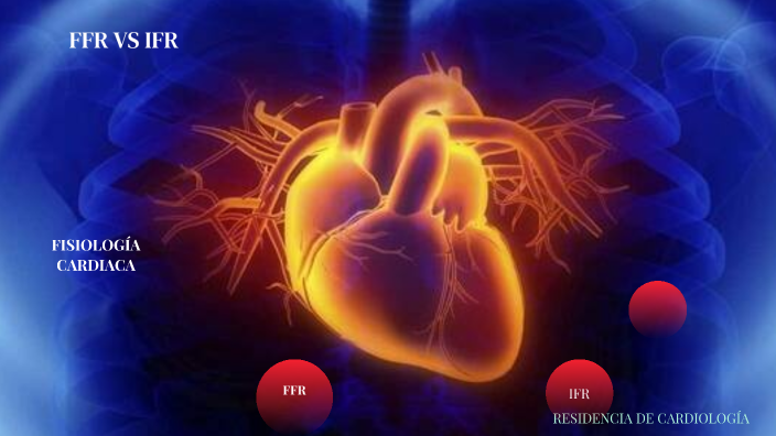 FFR VS IFR by OSCAR MAMANI on Prezi