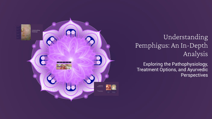 Understanding Pemphigus: An In-Depth Analysis by yusuf kazi on Prezi