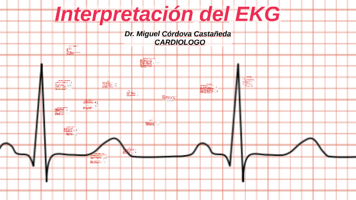 Interpretación EKG (2) by Miguel Cordova Castañeda on Prezi