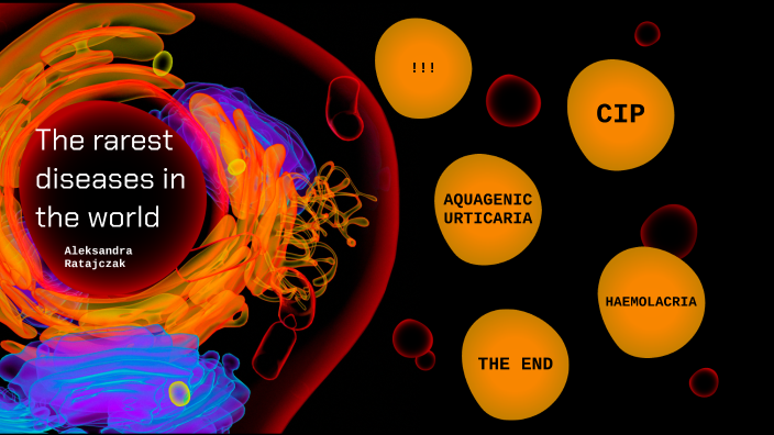 The rarest and most interesting diseases in the world by Just Aleks on ...
