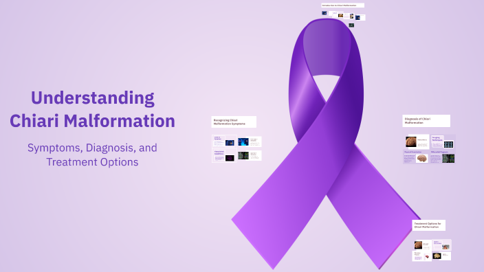 Understanding Chiari Malformation by Irina Hayes on Prezi