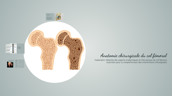 Anatomie chirurgicale du col fémoral by oussama bennafla on Prezi