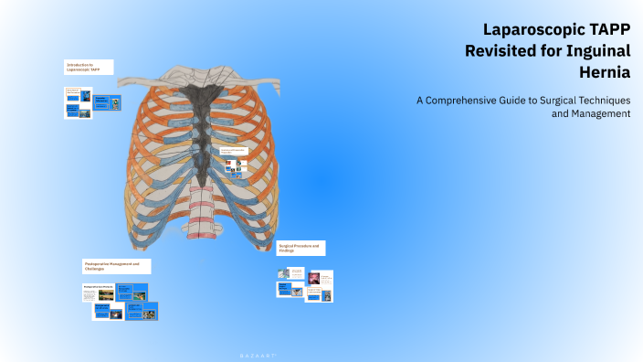 Laparoscopic TAPP Revisited for Inguinal Hernia by Bhavin Lohiya on Prezi