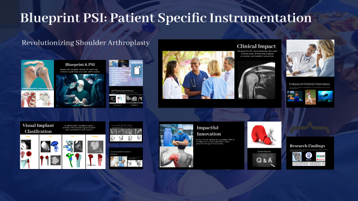 PSI: Patient Specific Instrumentation by Uriel Robles on Prezi