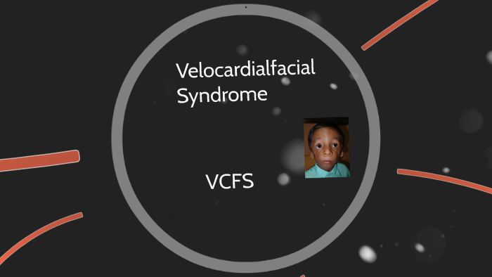 Velocardiofacial Syndrome by Stephen Mahle on Prezi