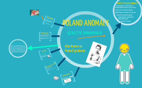 POLAND ANOMALY- Genetic Disorder Project by Maahin Ahmed on Prezi