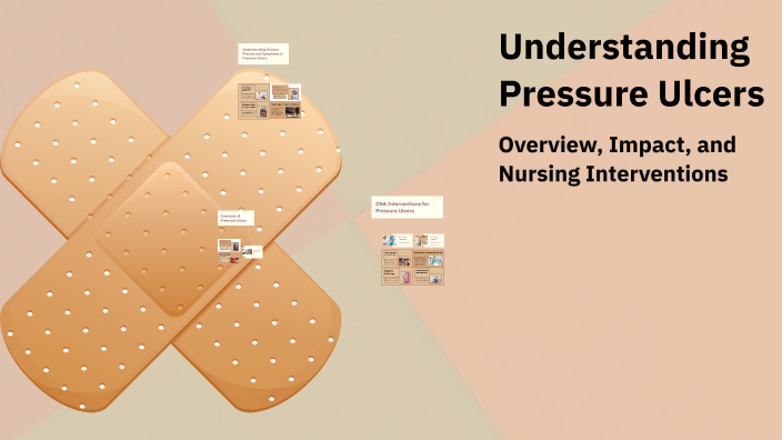 Understanding Pressure Ulcers by Natalie Ramirez on Prezi
