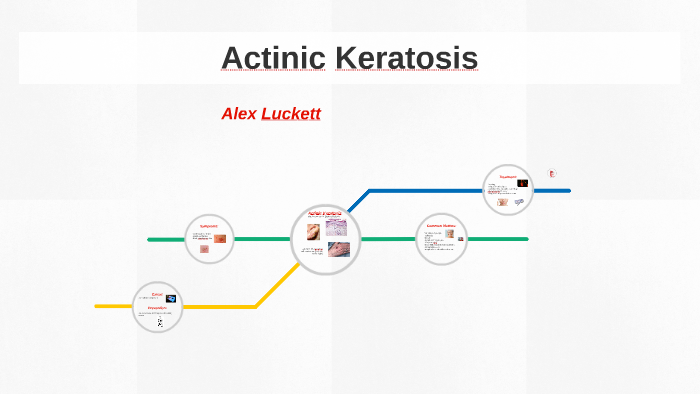 Actinic Keratosis by Alex Luckett on Prezi