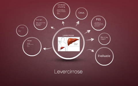 Levercirosse by cynthia de jonge on Prezi