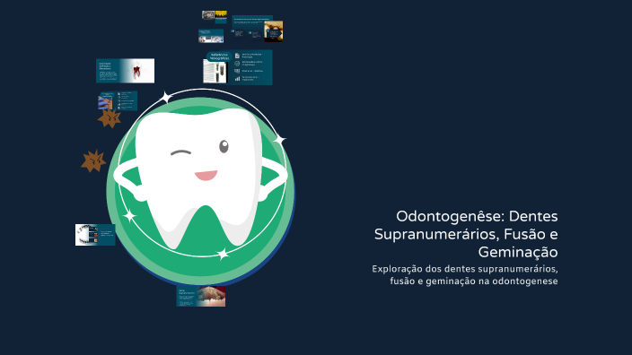Odontogenêse: Dentes Supranumerários, Fusão e Geminação by rafael ...